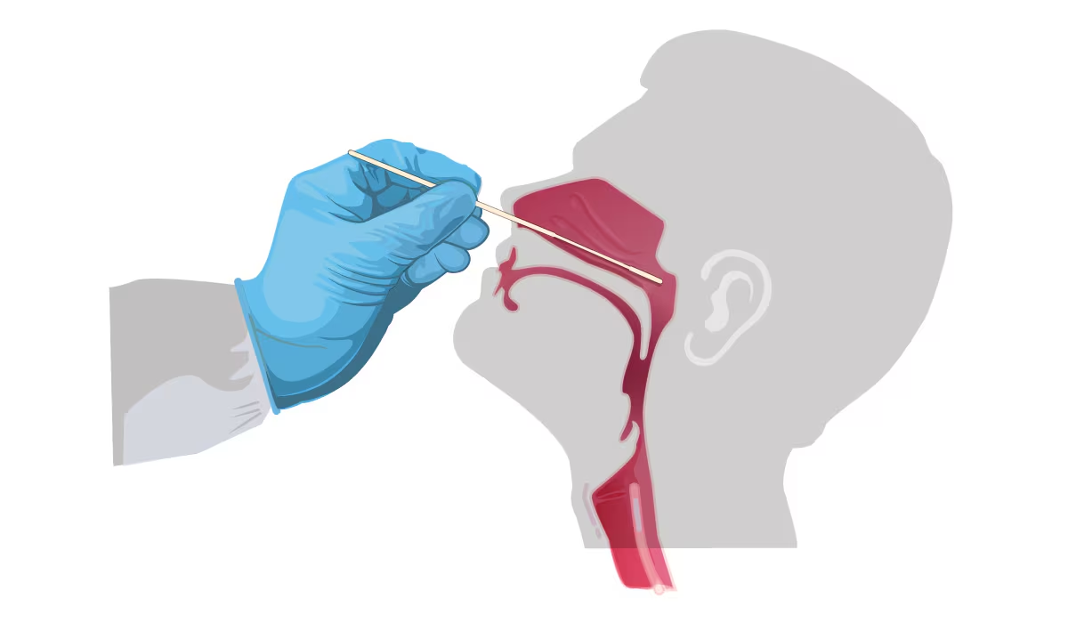 Nasal Sample Uptake for Diagnostic Testing