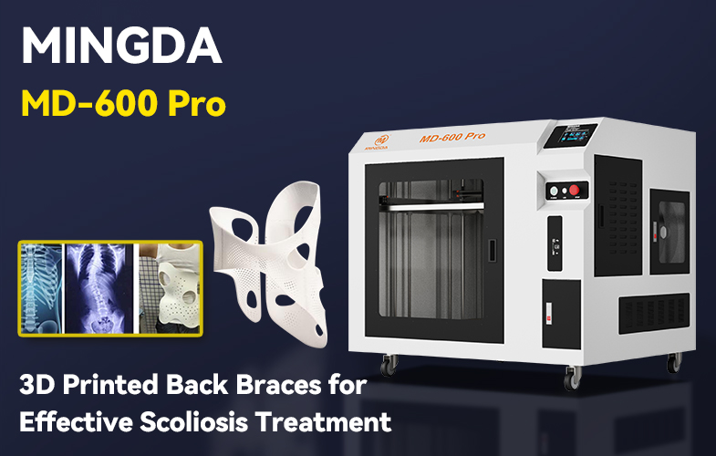How 3D Printed Back Braces for Effective Scoliosis Treatment ...