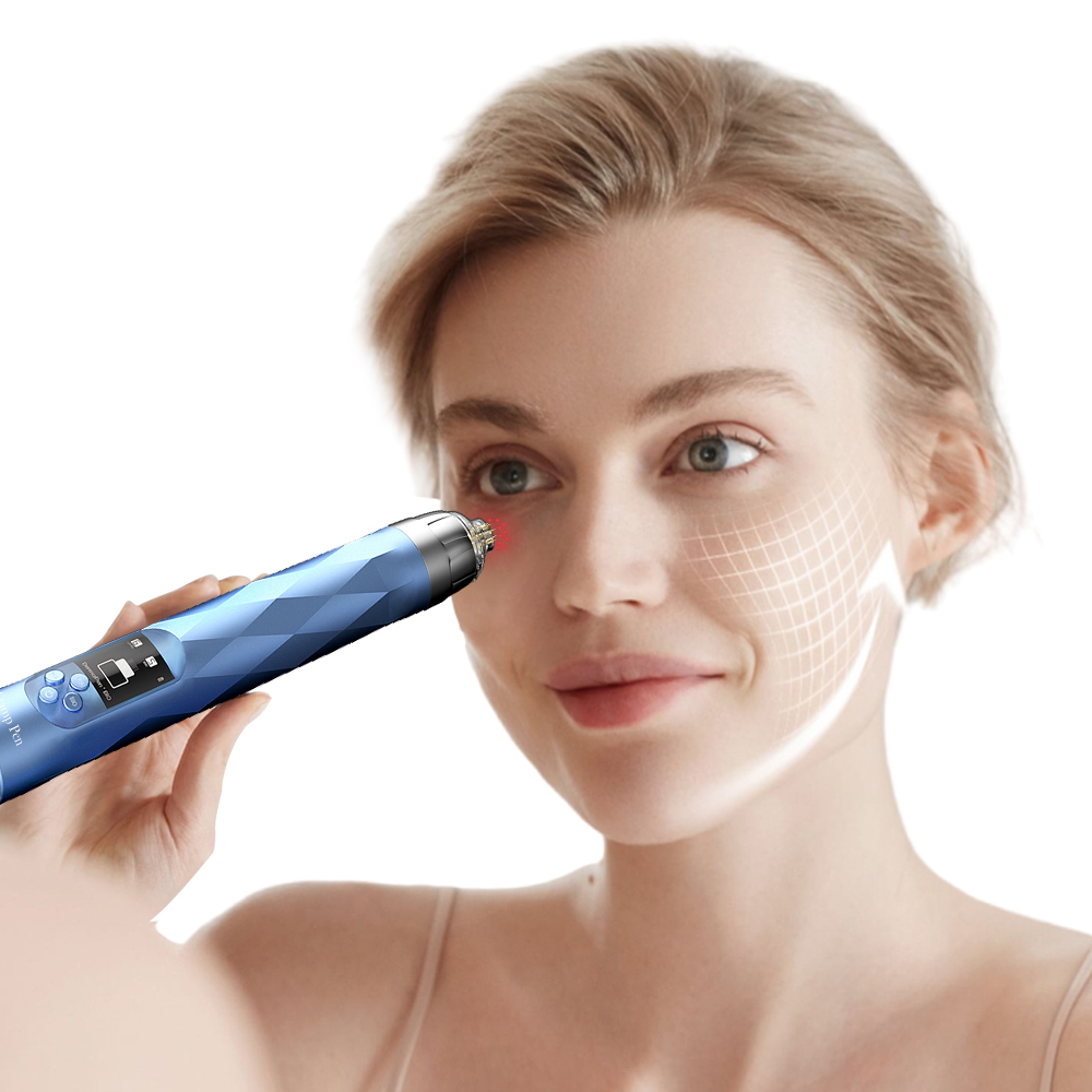 OstarBeauty Electrode Powered Microneedling Device With RF And LED ...
